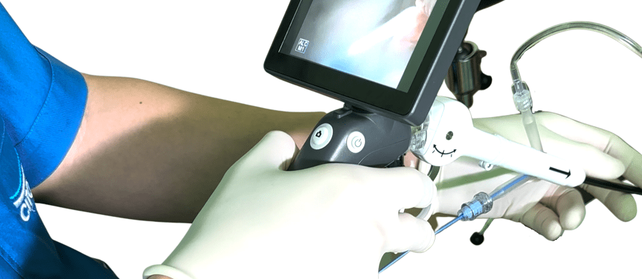 UroViu - Uro-GHD Fully Deflectable HD Cystoscope